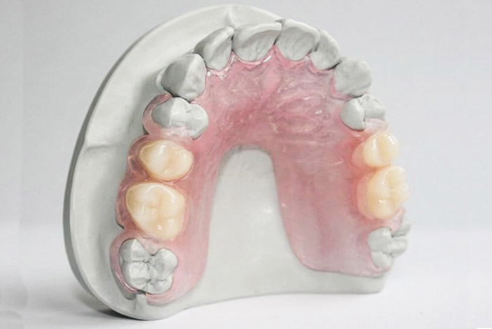 Our Frameworks Range | Hughes Dental Laboratory